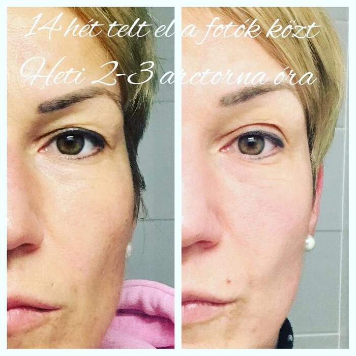 Átalakulások :: FitFace Arcvonal Arctorna - Facial Gymnastic Method